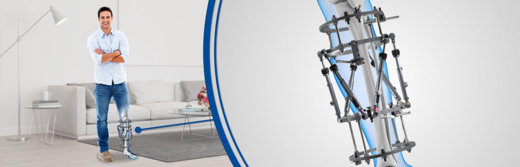 Surgeon: how to find the right one? | Limbhealing.com